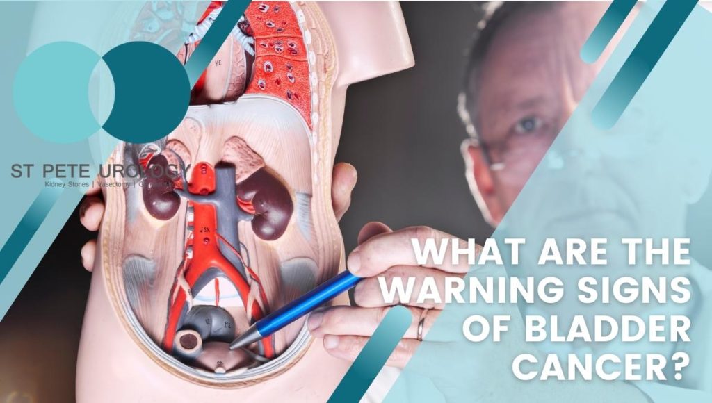 What are the warning signs of bladder cancer? | St Pete Urology