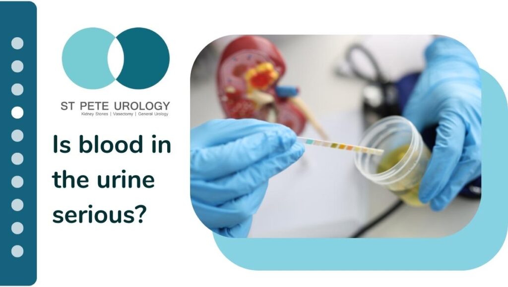 Is blood in the urine serious? | St Pete Urology