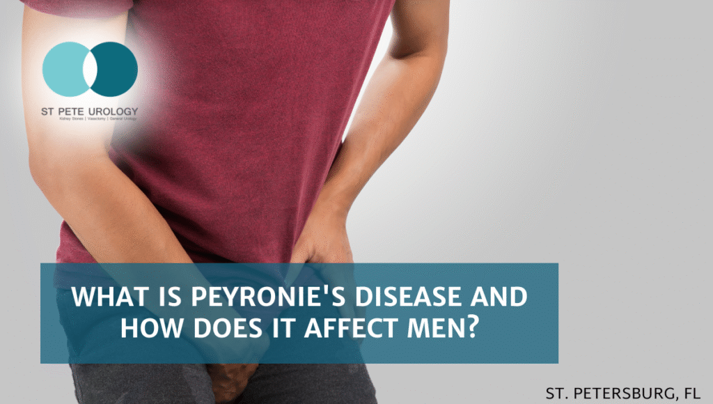 What Does a Vasectomy Procedure Look Like? An Animated Overview | St ...