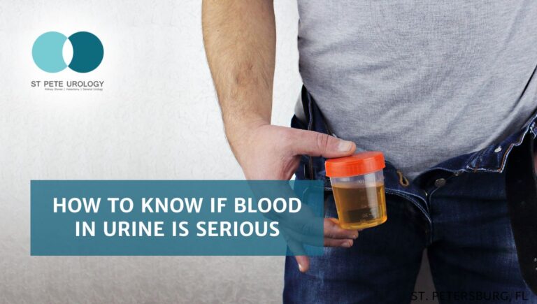How to know if blood in urine is serious? | St Pete Urology